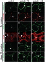 JAM-A (CD321) Polyclonal Antibody (36-1700)