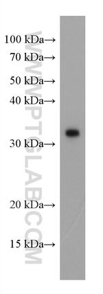 SARS-CoV-2 S protein (944-1214 aa) Monoclonal Antibody (1H5E6) (67794-1-IG)