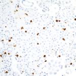 Anti-CD66b (CEACAM8) Antibodies | Invitrogen