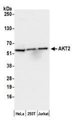 Anti-AKT2 Antibodies | Invitrogen