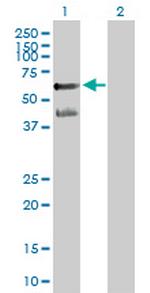 PPARA Polyclonal Antibody (H00005465-B01P)