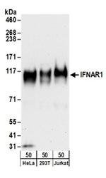 Anti-IFNAR1 Antibodies | Invitrogen