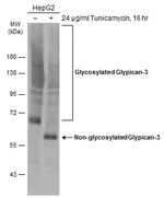 Anti-Glypican 3 Antibodies | Invitrogen