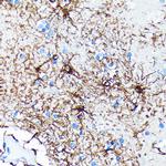 Anti-GFAP Antibodies | Invitrogen