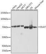 Anti-DLAT Antibodies | Invitrogen