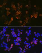 Anti-iNOS Antibodies | Invitrogen