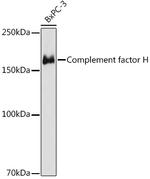 Anti-Complement Factor H Antibodies | Invitrogen
