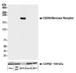 Anti-CD206 (MMR) Antibodies | Invitrogen