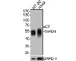 Anti-SLC7A11 Antibodies | Invitrogen