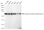 EIF2A Recombinant Monoclonal Antibody (23GB1455) (MA5-53162)