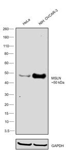 Anti-MSLN Antibodies | Invitrogen