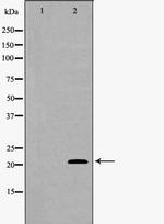 SFTPC Polyclonal Antibody (PA5-102493)