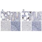 Anti-CD41 Antibodies | Invitrogen