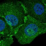 Anti-MBP Antibodies | Invitrogen