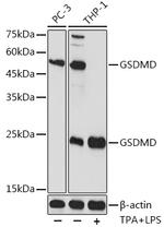 Anti-GSDMD Antibodies | Invitrogen