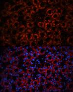 Anti-NGAL Antibodies | Invitrogen