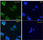 Anti-ACTA2 Antibodies | Invitrogen