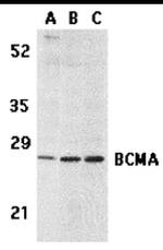 Anti-BCMA Antibodies | Invitrogen