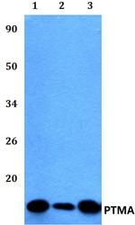 PTMA Polyclonal Antibody (PA5-75828)