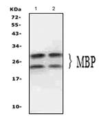 Anti-MBP Antibodies | Invitrogen