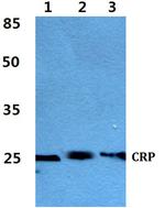 Anti-CRP Antibodies | Invitrogen