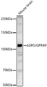 LGR5 Polyclonal Antibody (PA5-87974)