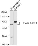 Anti-Glypican 3 Antibodies | Invitrogen