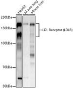 Anti-LDLR Antibodies | Invitrogen