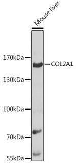 Anti-Collagen II Antibodies | Invitrogen