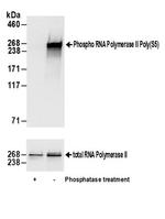 Anti-RNA pol II CTD Antibodies | Invitrogen