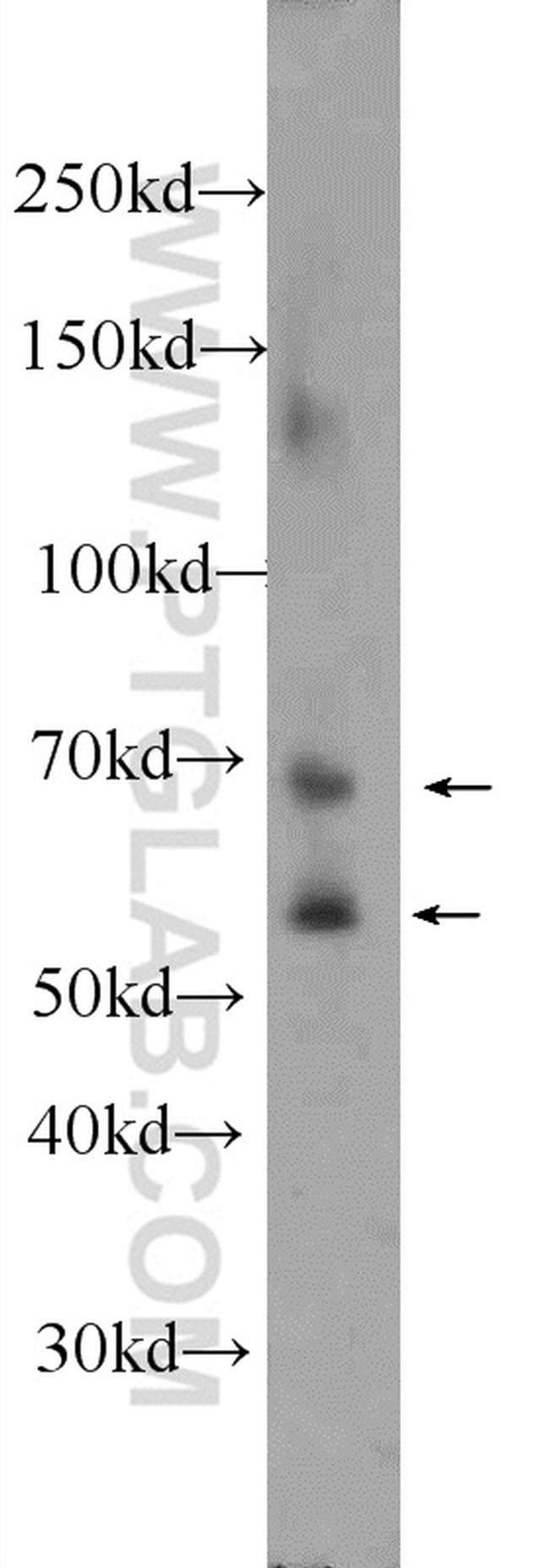 MMP2 Antibody (10373-2-AP)