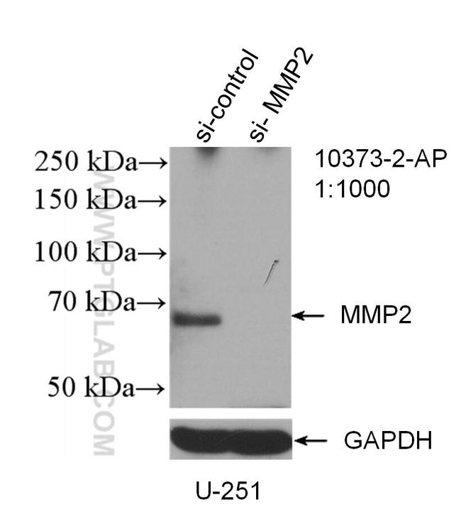 MMP2 Antibody (10373-2-AP)