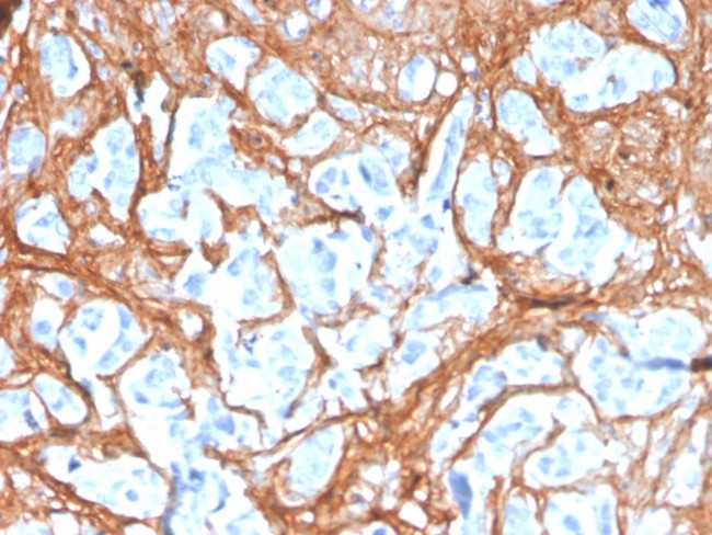 Periostin (POSTN) Antibody (10631-MSM3-P1)