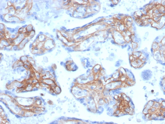 Periostin (POSTN) Antibody (10631-MSM3-P1)