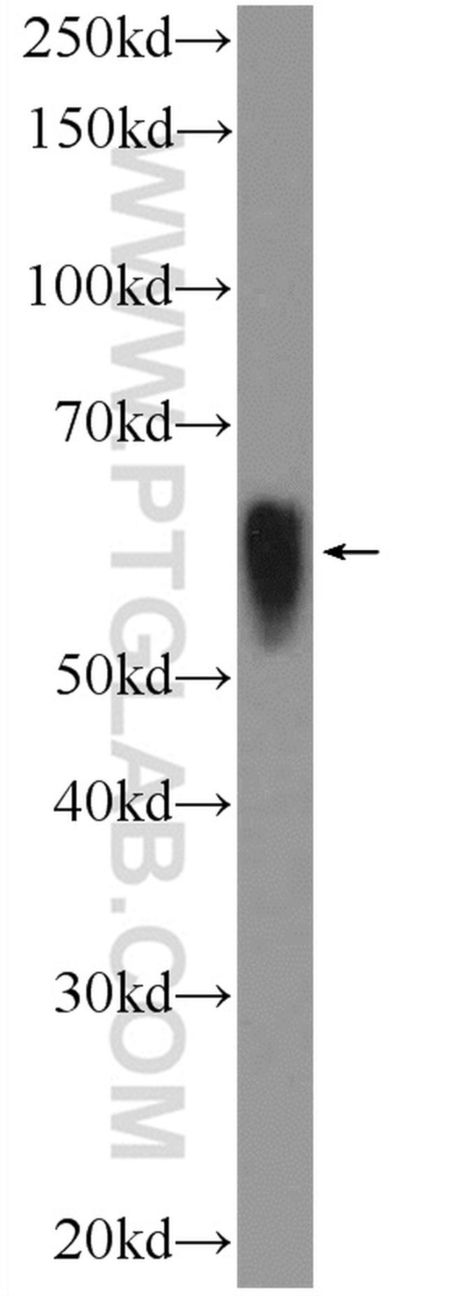 alpha Tubulin Antibody (11224-1-AP)