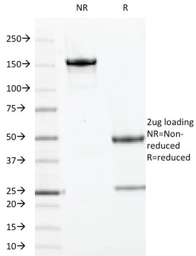 Topoisomerase (DNA) I, Mitochondrial (TOP1MT) Antibody (116447-MSM3-P1ABX)
