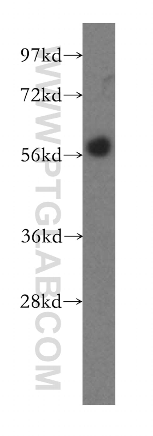 GPR183/EBI2 Antibody (12377-1-AP)