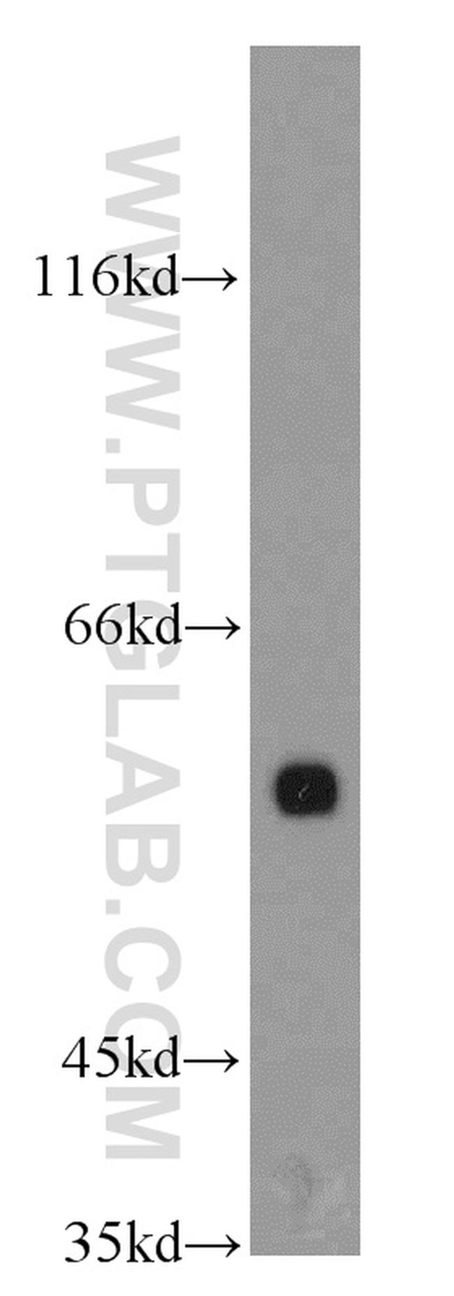 HNF1B Antibody (12533-1-AP)