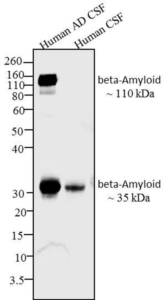 beta Amyloid Antibody (13-0100Z)