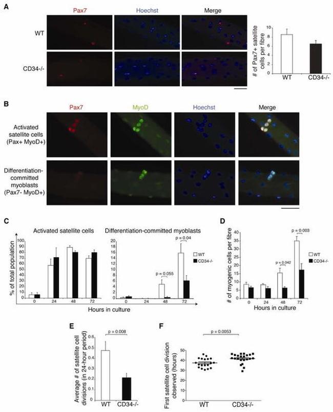 CD34 Antibody (14-0341-82)
