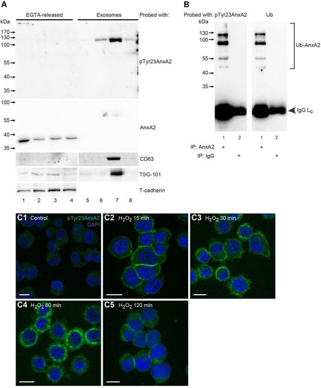 Ubiquitin Antibody (13-1600)