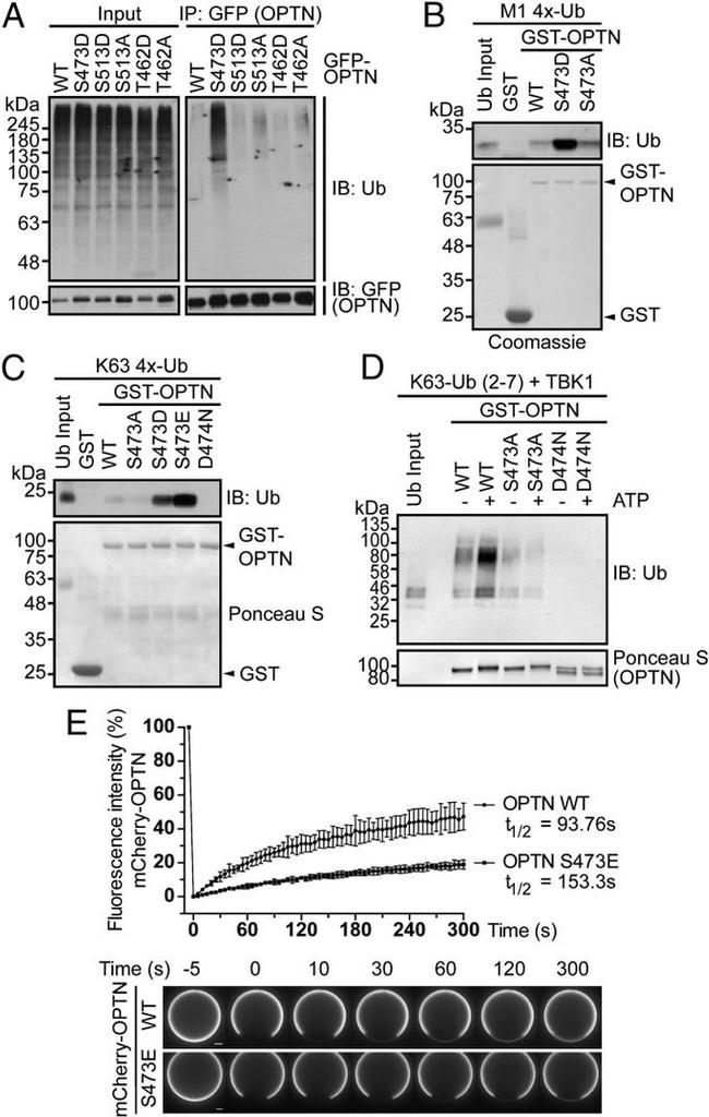 Ubiquitin Antibody (13-1600)