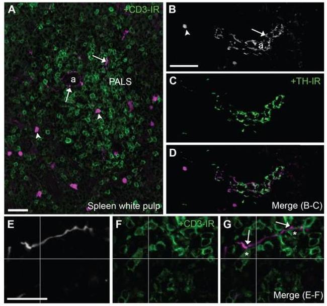 CD3 Antibody (14-0032-82)