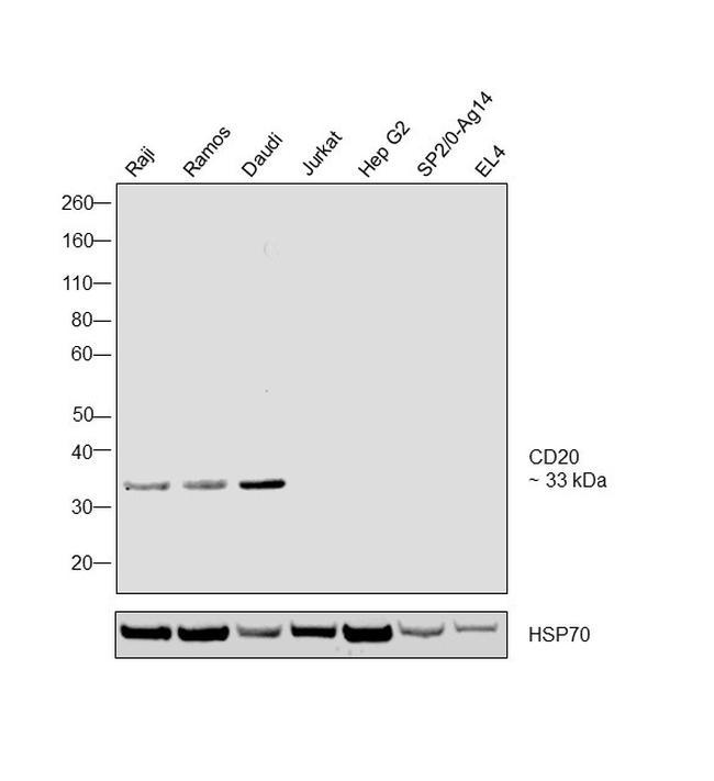 CD20 Monoclonal Antibody (L26) (14-0202-82)