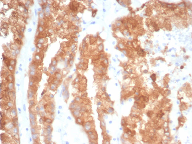 Crystallin Alpha B Monoclonal Antibody (CRYAB/4663) (1410-MSM13-P0)