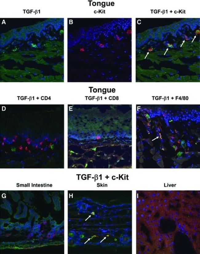 CD117 (c-Kit) Antibody (14-1172-82)