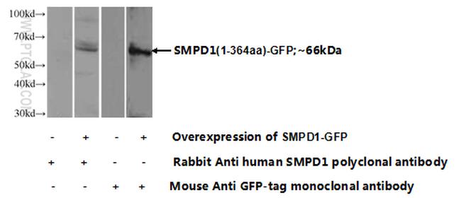 SMPD1/ASM Antibody (14609-1-AP)