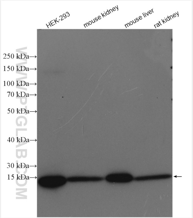 SEC61B Polyclonal Antibody (14846-1-AP)