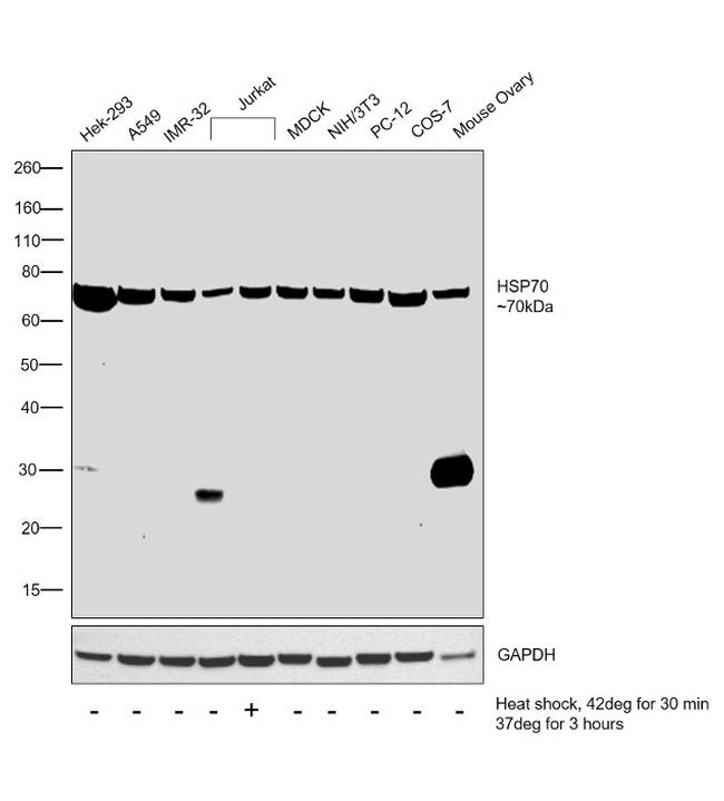 HSP70 Monoclonal Antibody (1B2hsp70) (14-9115-37)