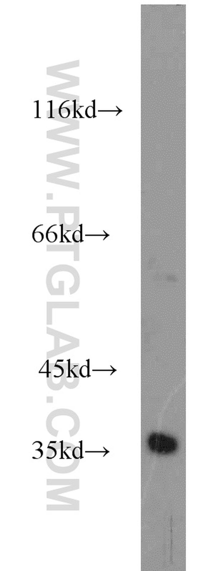 SUCLG1 Antibody (14923-1-AP)